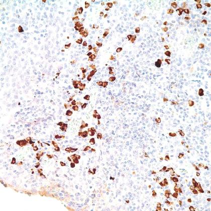 MUM1 Antibody Reagent for Immunohistochemistry,Primary Antibodies ...