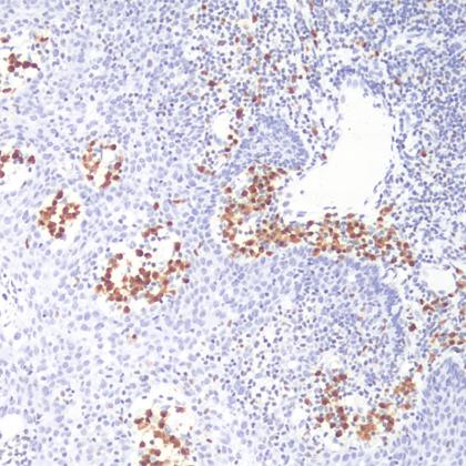 MUM1 Antibody Reagent for Immunohistochemistry,Primary Antibodies ...