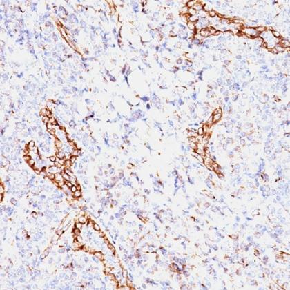 VEGF Antibody Reagent for Immunohistochemistry,Primary Antibodies ...